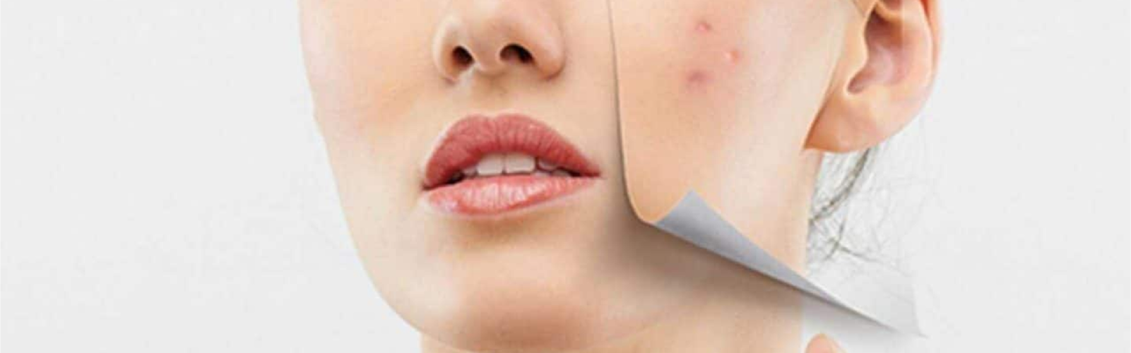 Skin Problems - Dermatologist